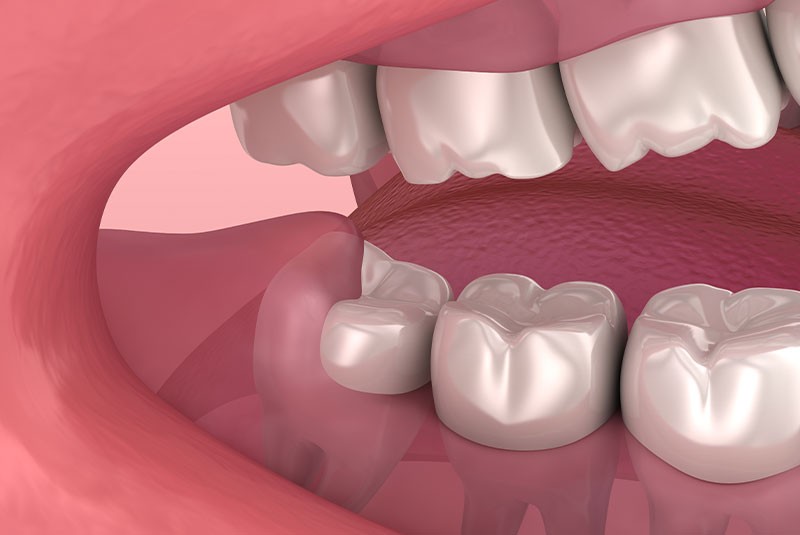 Olney Center for Oral & Maxillofacial Surgery | Oral Surgeon Near Me