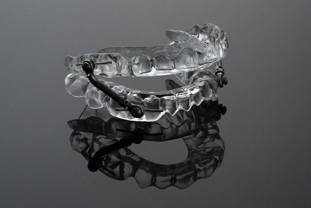 TMJ Treatment | Olney Center for Oral & Maxillofacial Surgery